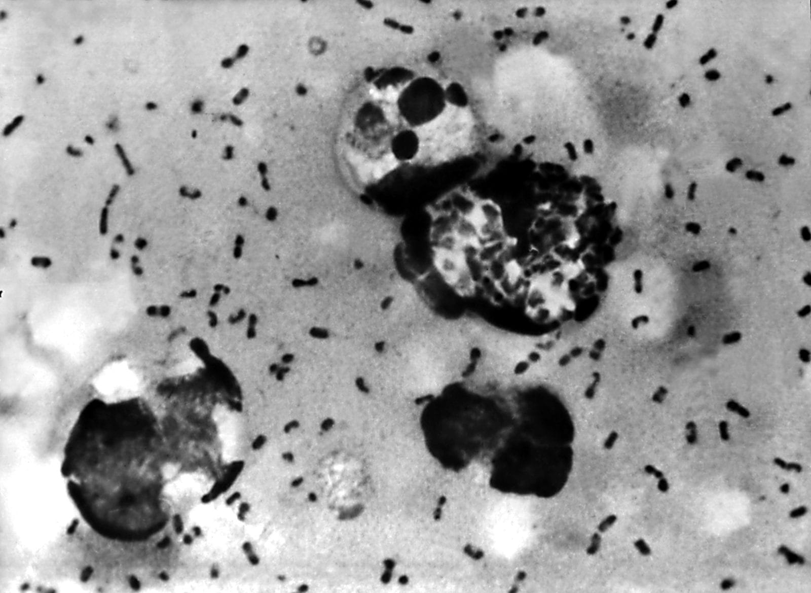 Pneumonic Plague Death in Arizona Sparks Questions About Disease Risk ...